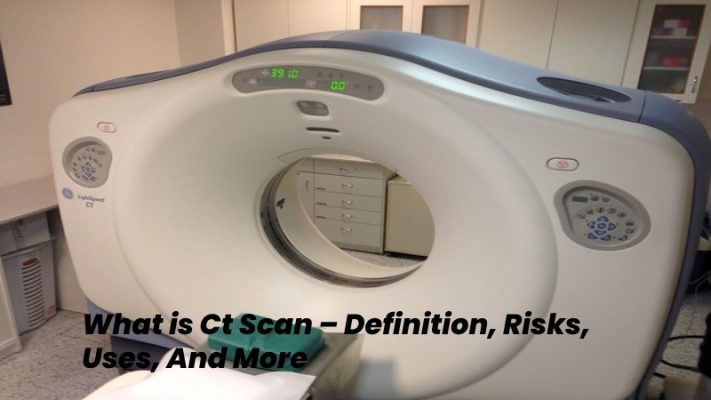 What is Ct Scan – Definition, Risks, Uses, And More