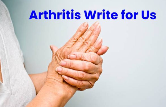 Arthritis Write for Us – Submit and Contribute Post